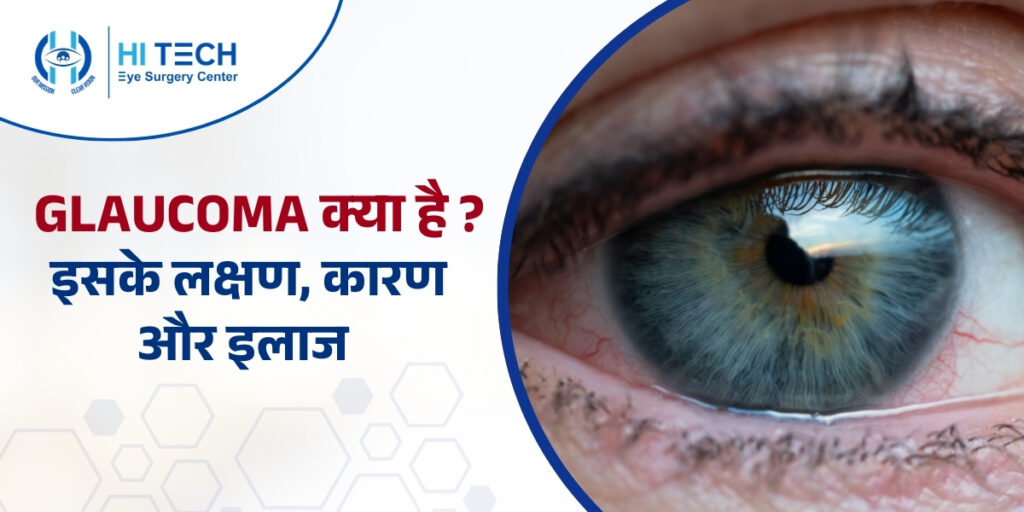 Glaucoma Treatment | Hi Tech Eye Surgery Center