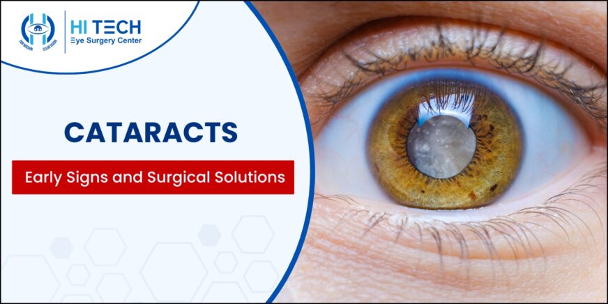 Cataracts: Early Signs and Surgical Solutions | Hi Tech Eye Surgery Center